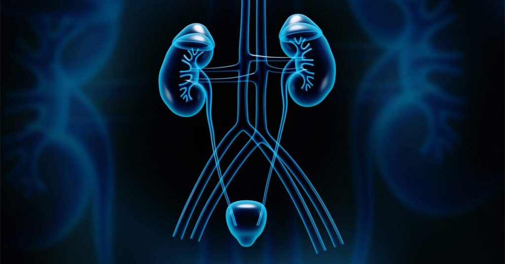 Ureteral Stents: What You Should Know - Urology Center of Iowa